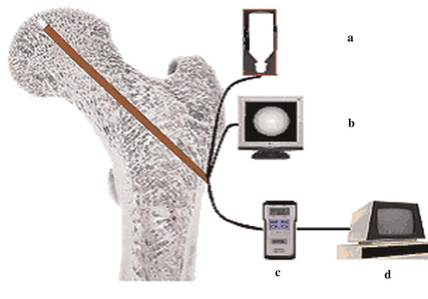 (PDF) Osteoscopy for Assessment of Blood Supply to the Femoral Head