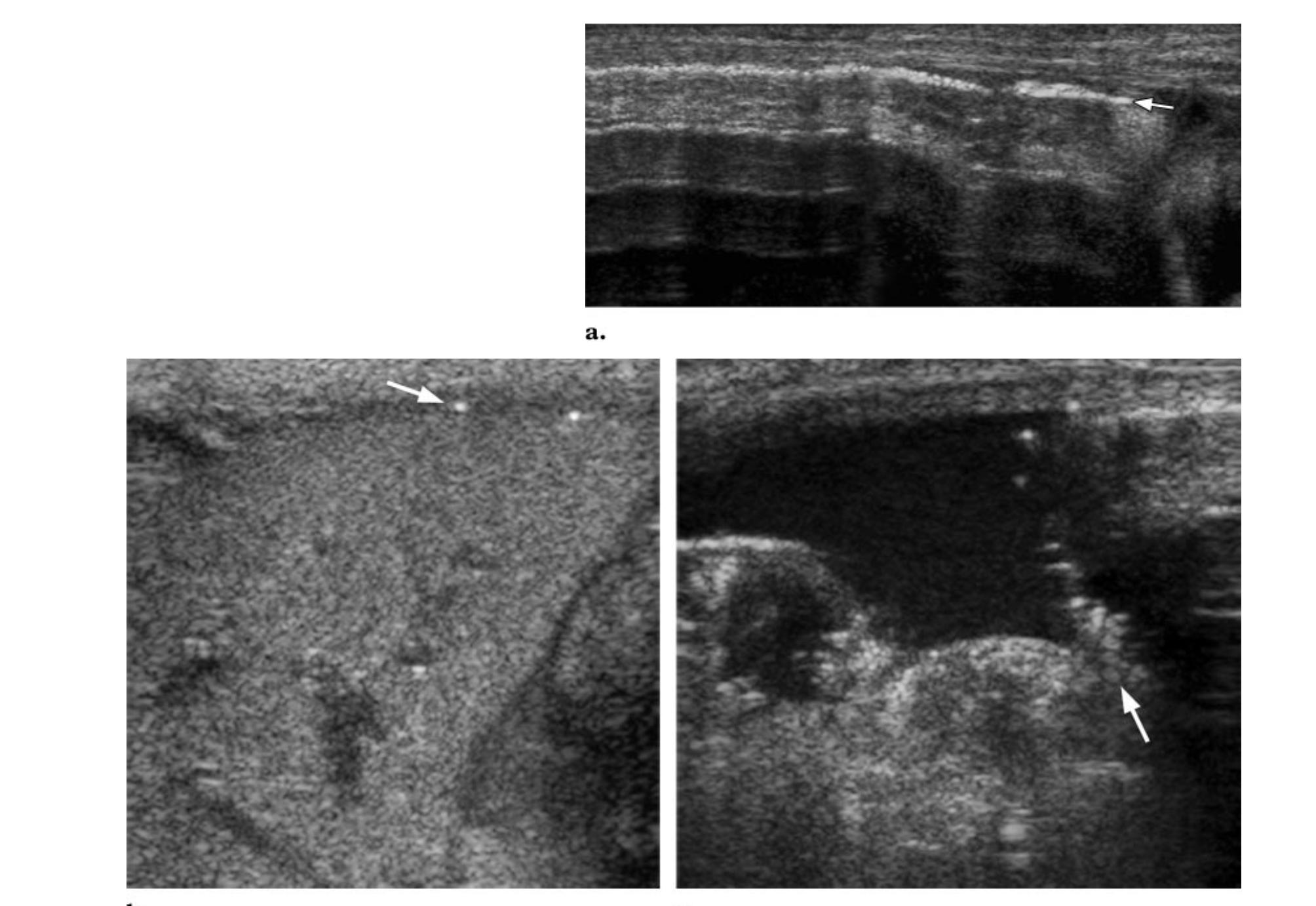 Sonograms show the spectrum of appearances of free