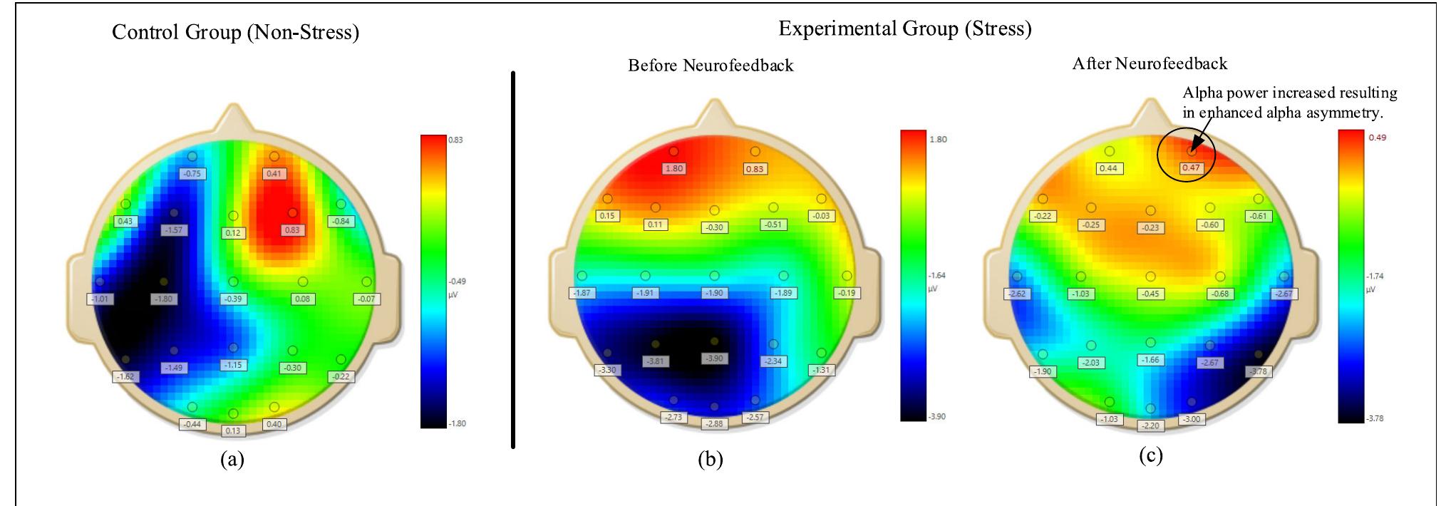 The topographic maps show (a) the mean value of alpha power