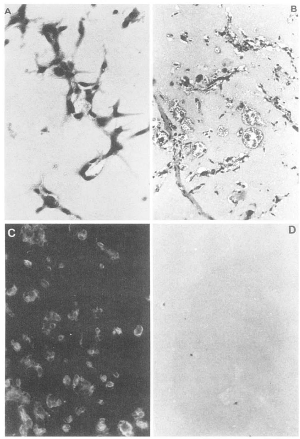 Histologic analysis of matrigel plugs. hematoxy- lin-eosin