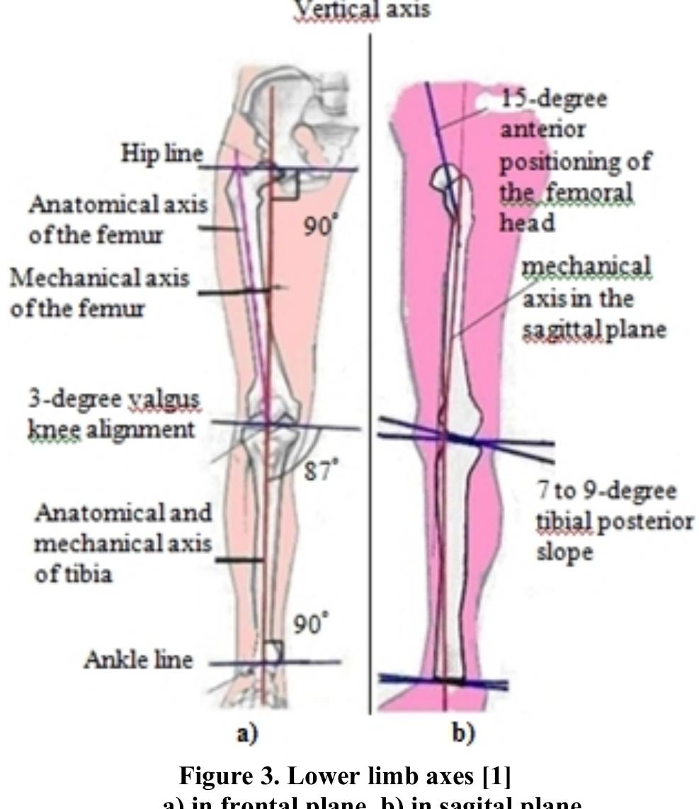 The mechanical axis of the lower limb is defined as an axis