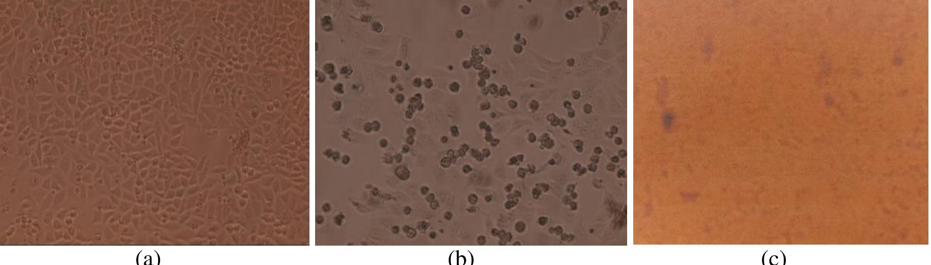 (a) morphology of mcf-7 cell line in rpmi medium after