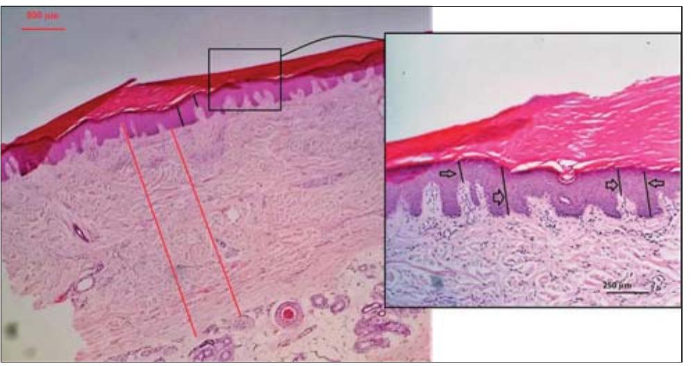 Figure 4 - Measurement of epidermis, dermis, and total skin