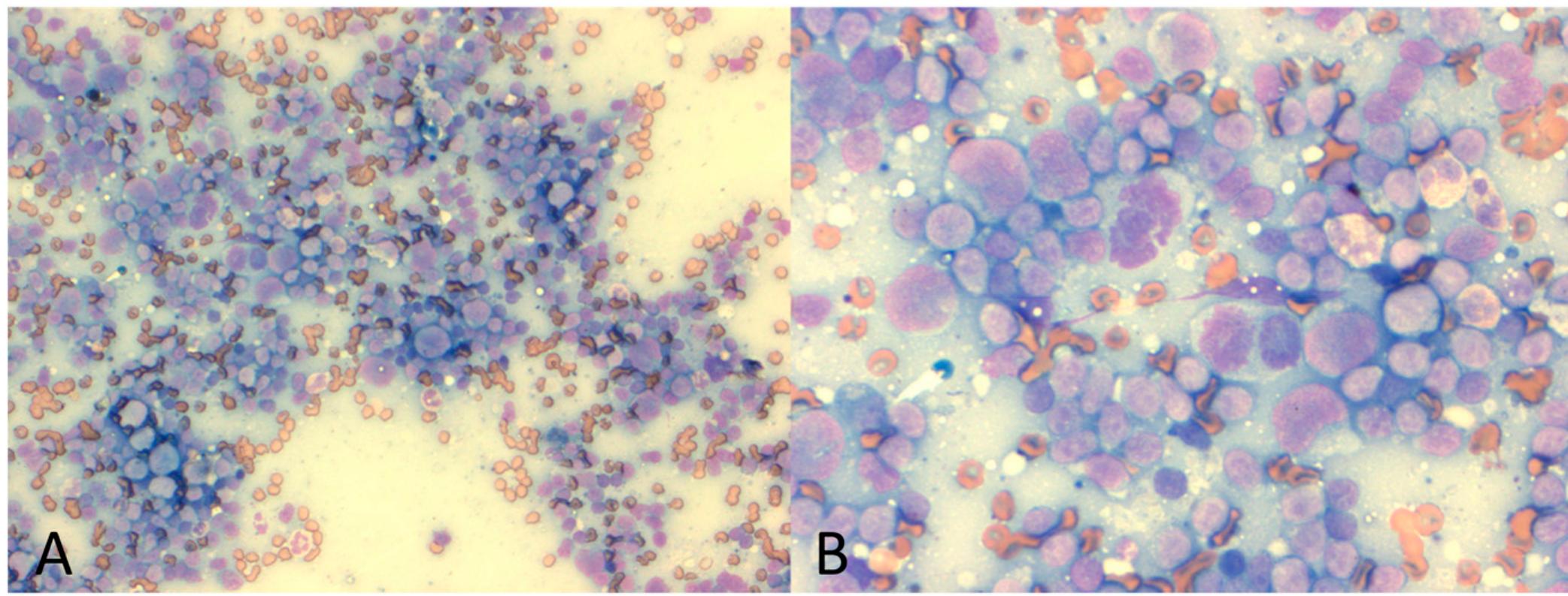 Cytologic evaluation of the left mandibular lymph node: many
