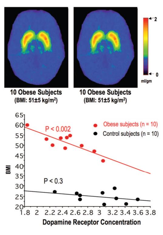 Figure 2 - Imaging of Brain Dopamine Pathways