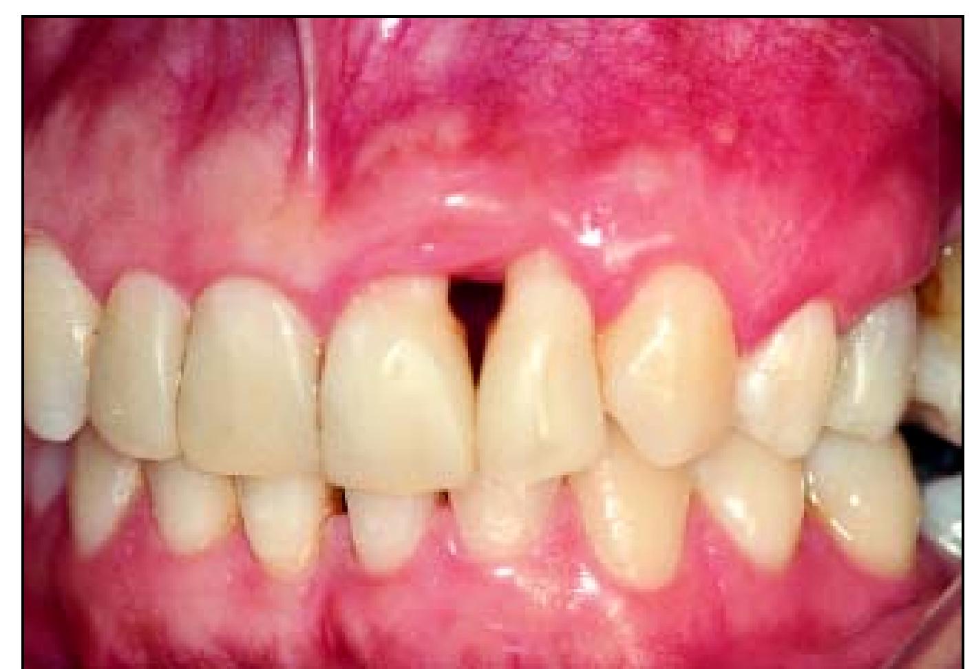 Preoperative view of 20-year-old woman with severe loss of