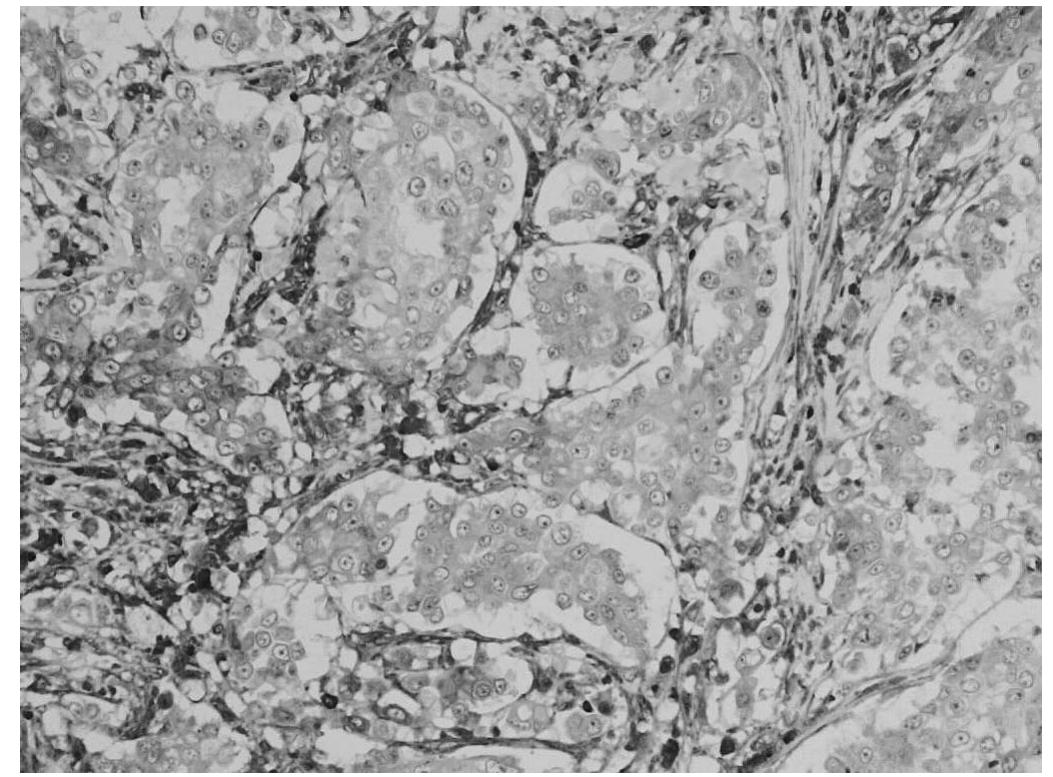 Figure 14 - from Therapeutic Efficacy of Attenuated Listeria