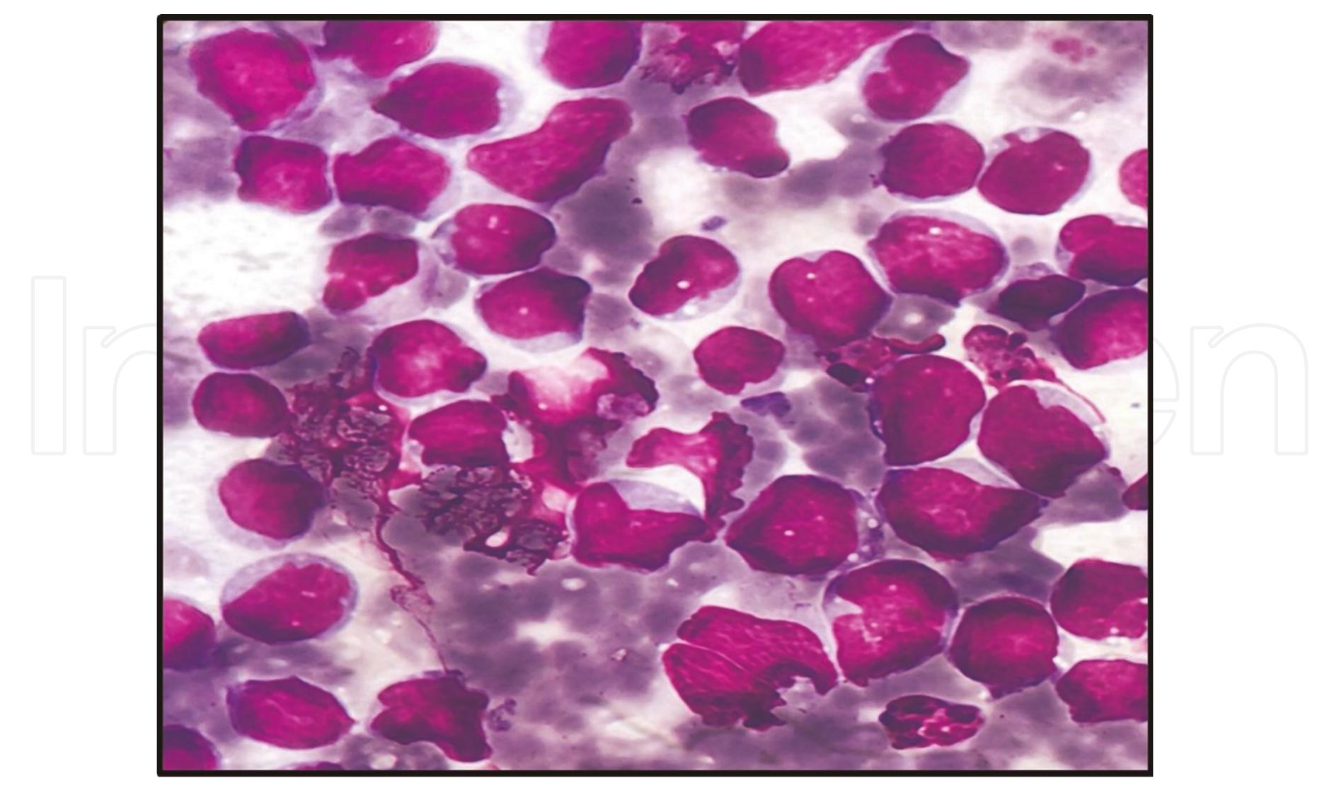 Lymph Node Cytology Morphology And Beyond Doi 4648