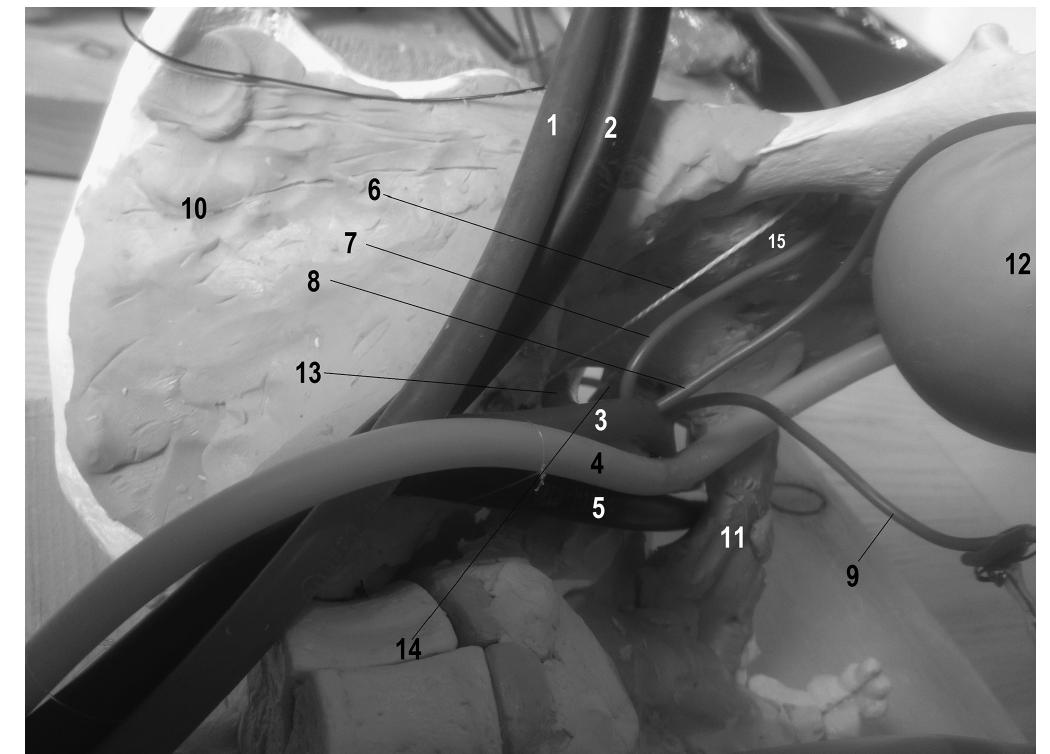 Pelvic lymph node model with model vasculature and ureter.