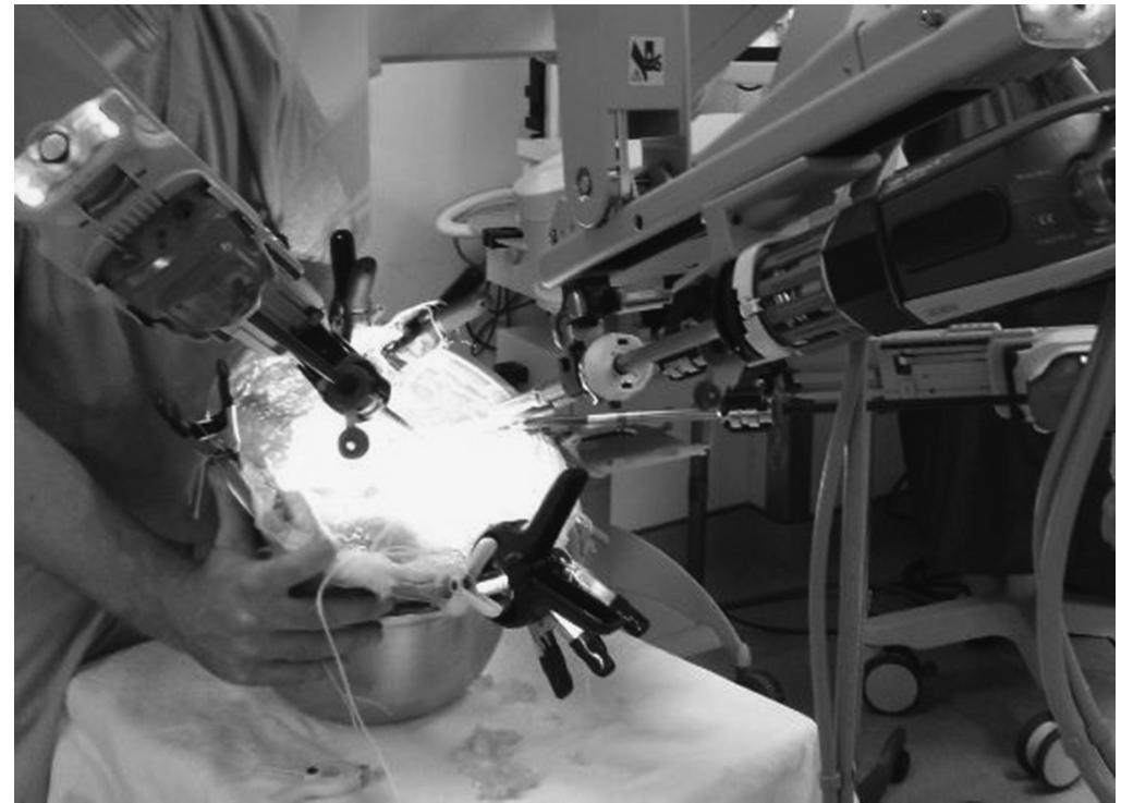 Setup of the pelvic lymph node model during a trial robotic