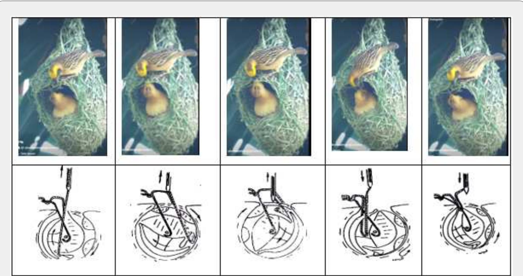 Show the stages of constriction the stitches of building