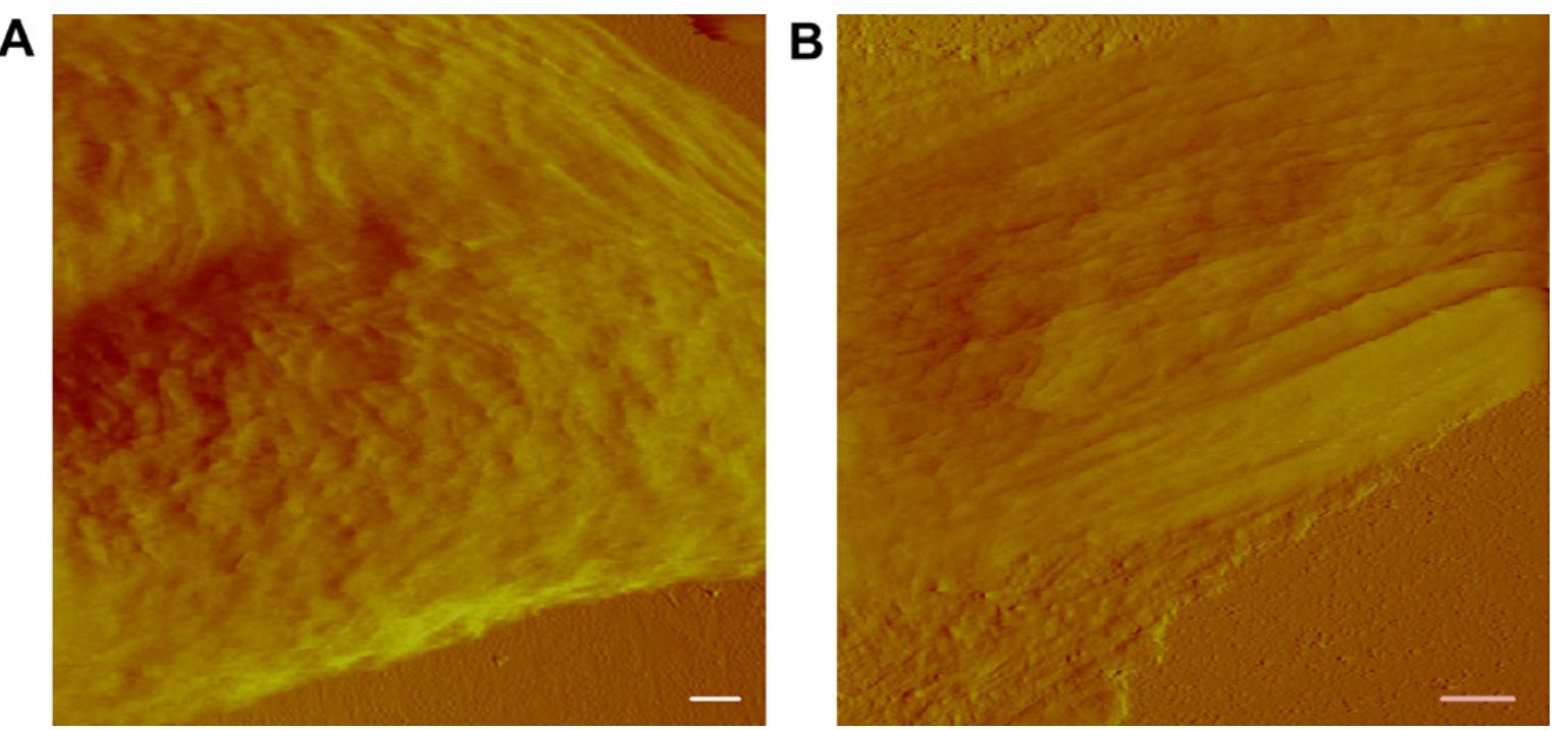 Afm deflection image (mechanically based contrast) of the