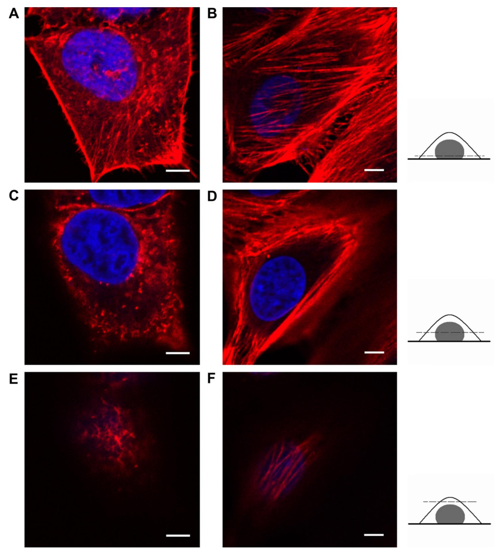 Confocal microscopy planes of f-actin (red) in fixed (a, c,