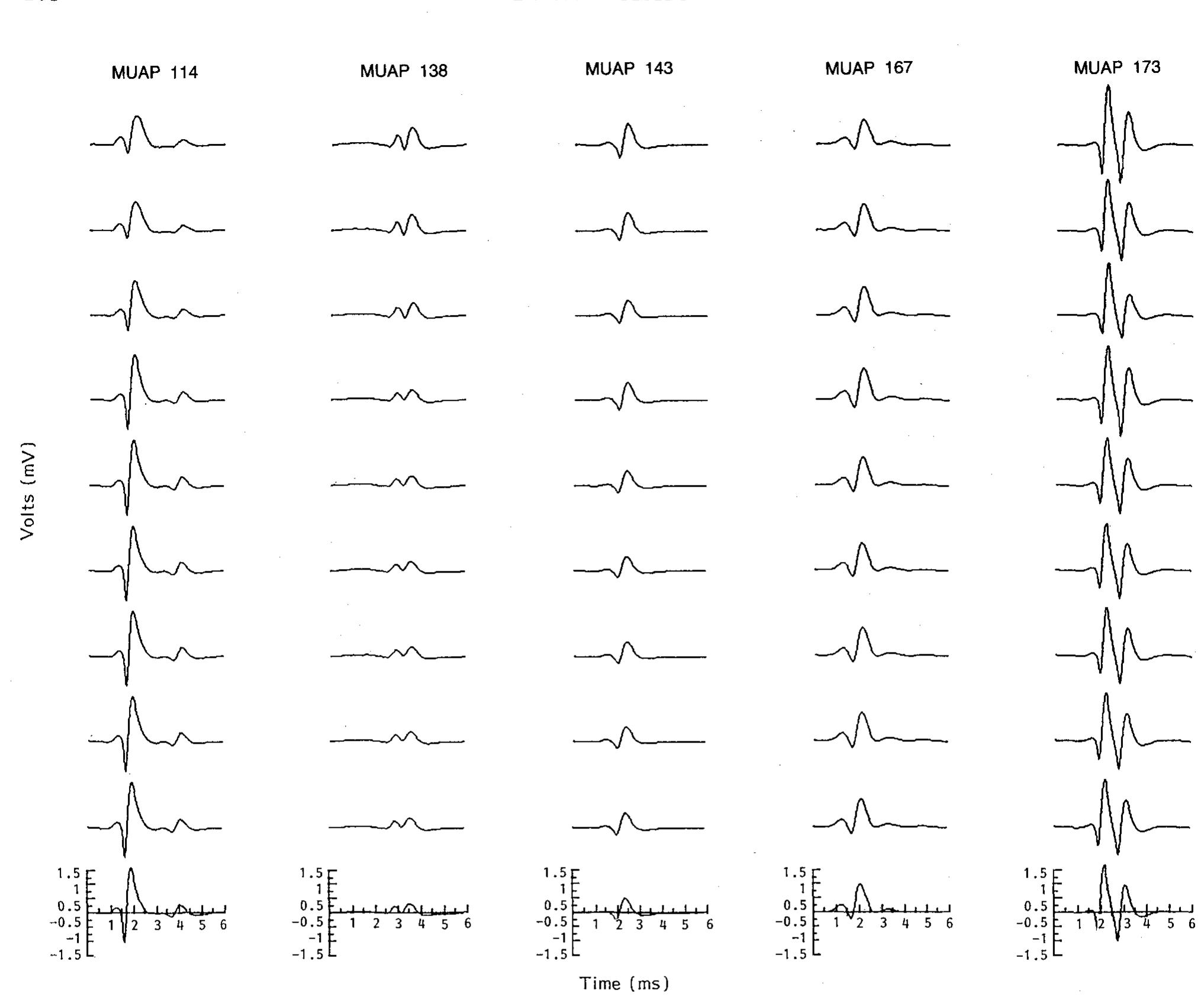 Shown are 10 motor unit action potentials (muaps) from five