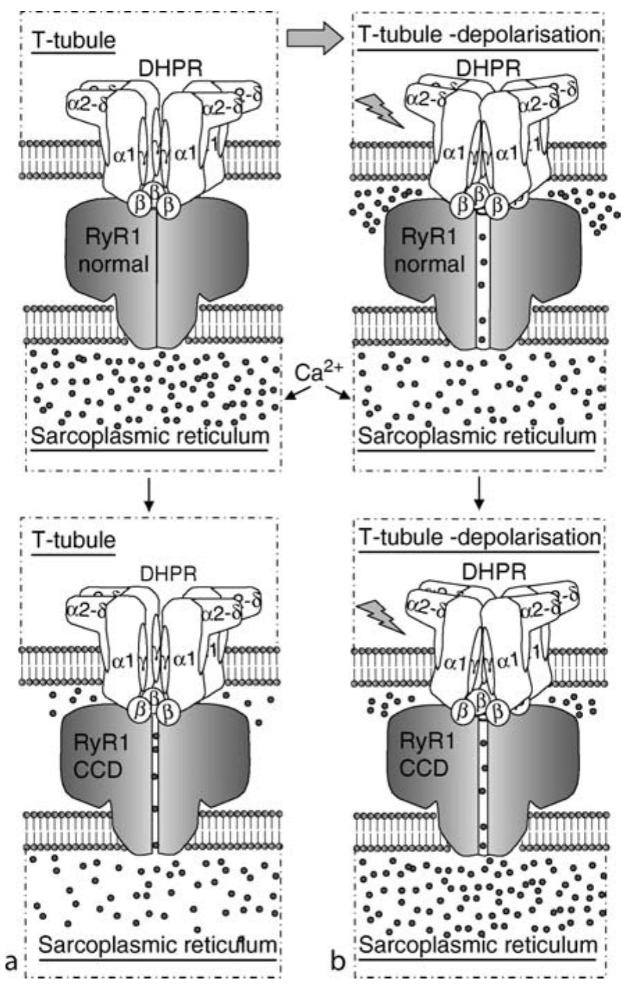 Central core and multi-minicore disease. figure 1 schematic