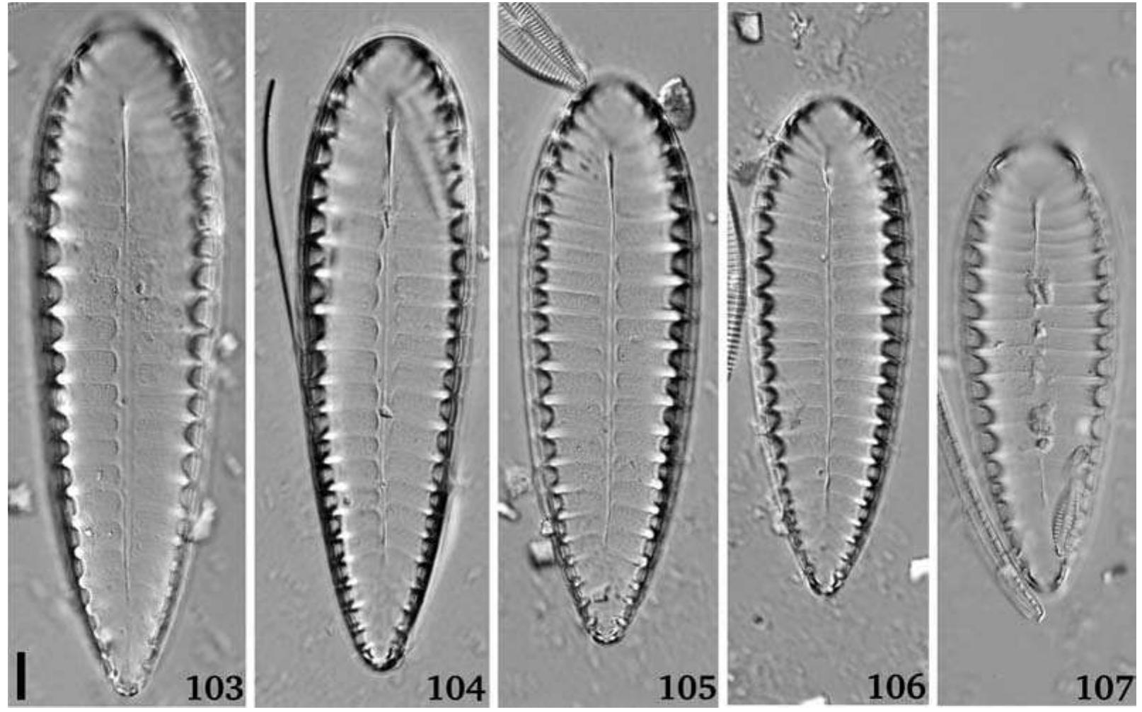 S103 -107. surirella pinnigera lm. valves showing the size