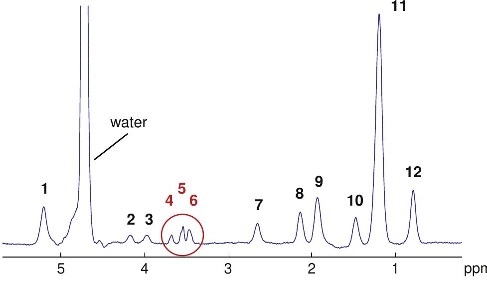 Steam spectrum of intralipid® at 9.4 t. the encircled peaks,
