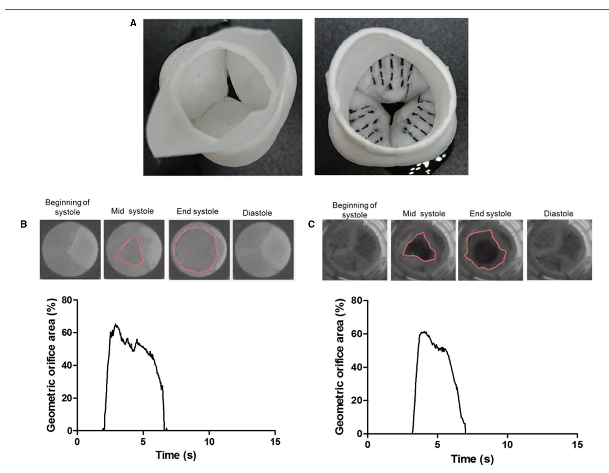| the ventricular view of a tissue-engineered valve root