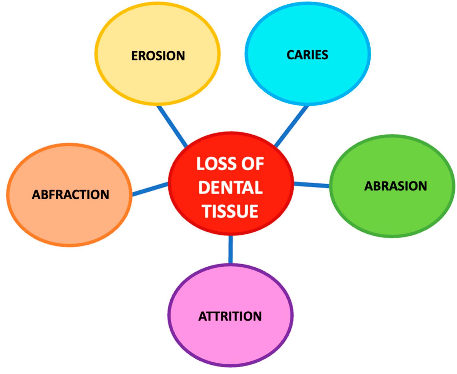 Diagram of the causes of tooth tissue loss.