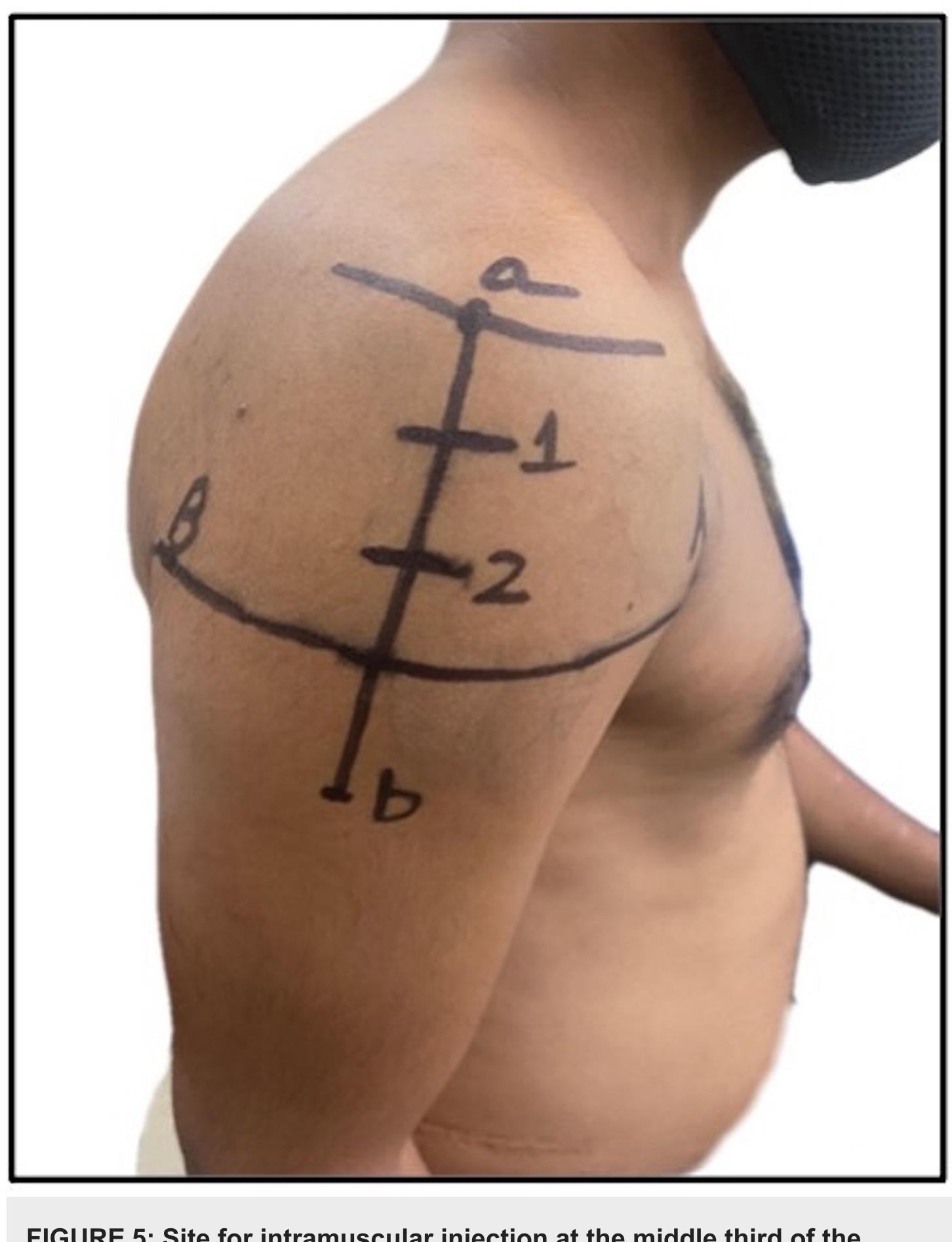 Figure 8 - Deltoid Intramuscular Injections: A Systematic