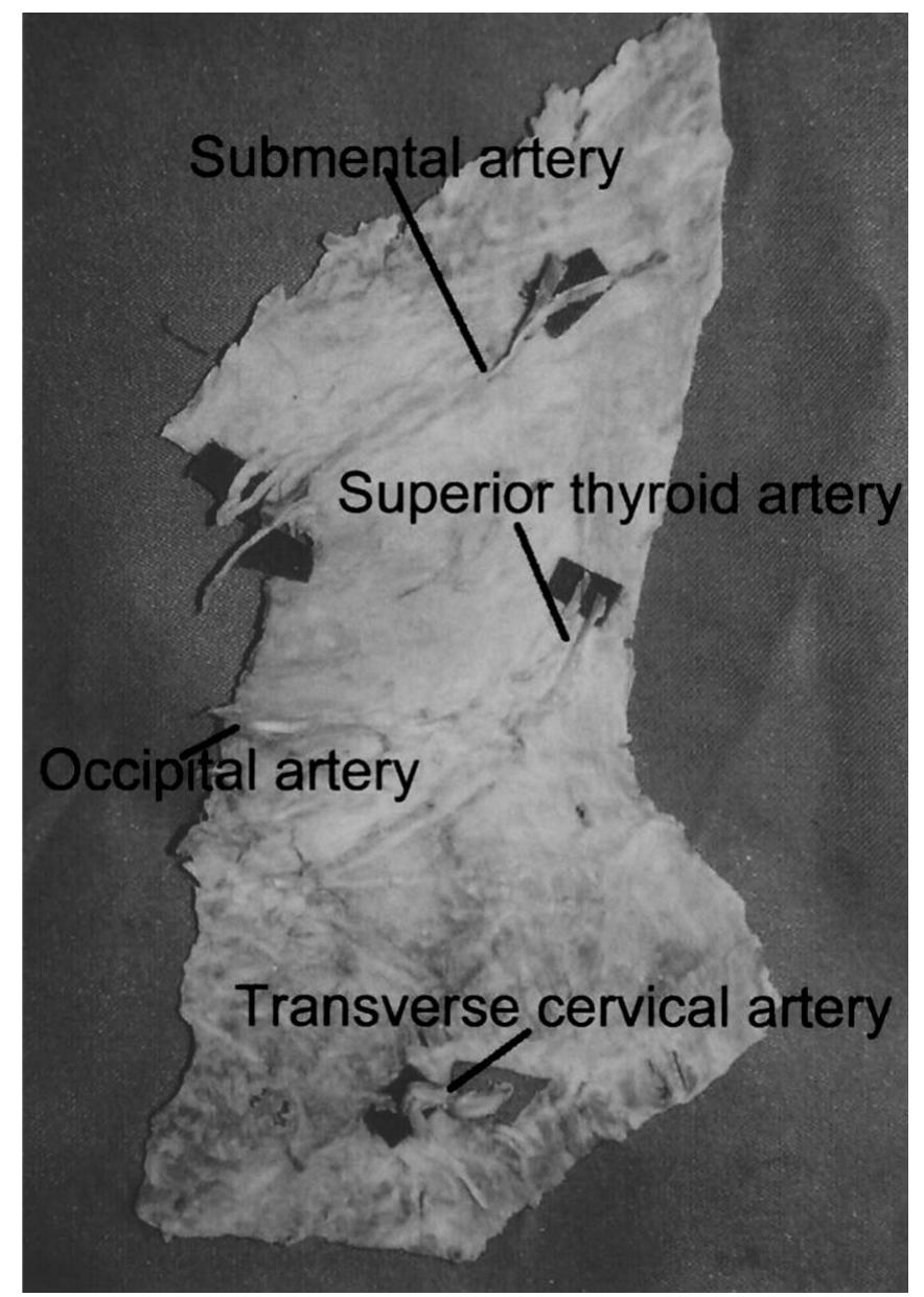 Vascular anatomy of the platysma muscle on cadav- eric