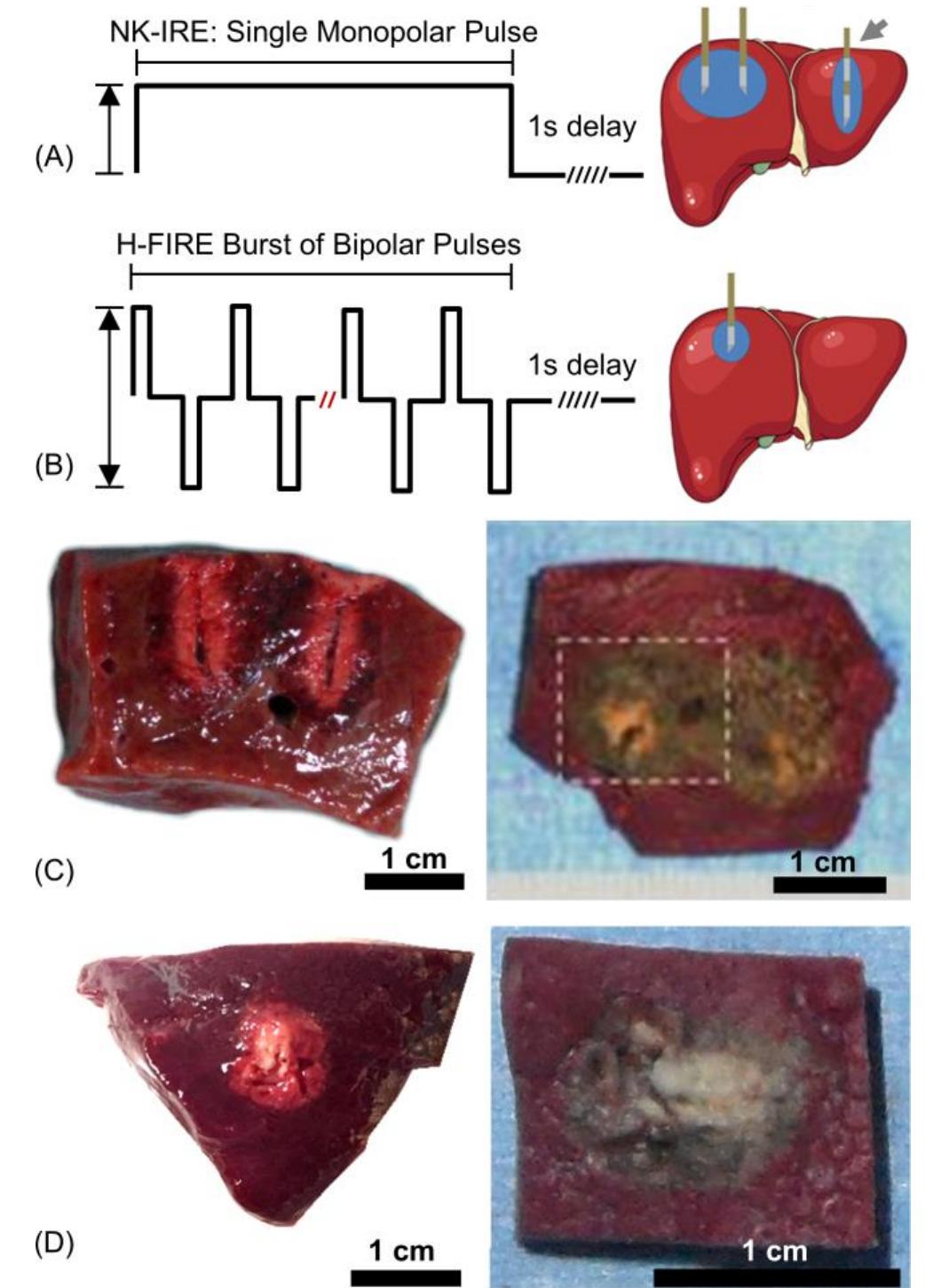 H-fire treatment for single electrode ire. schematics of (a)