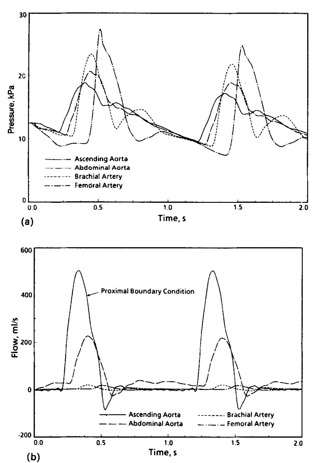 Figure 3 - Computer simulation of arterial flow with