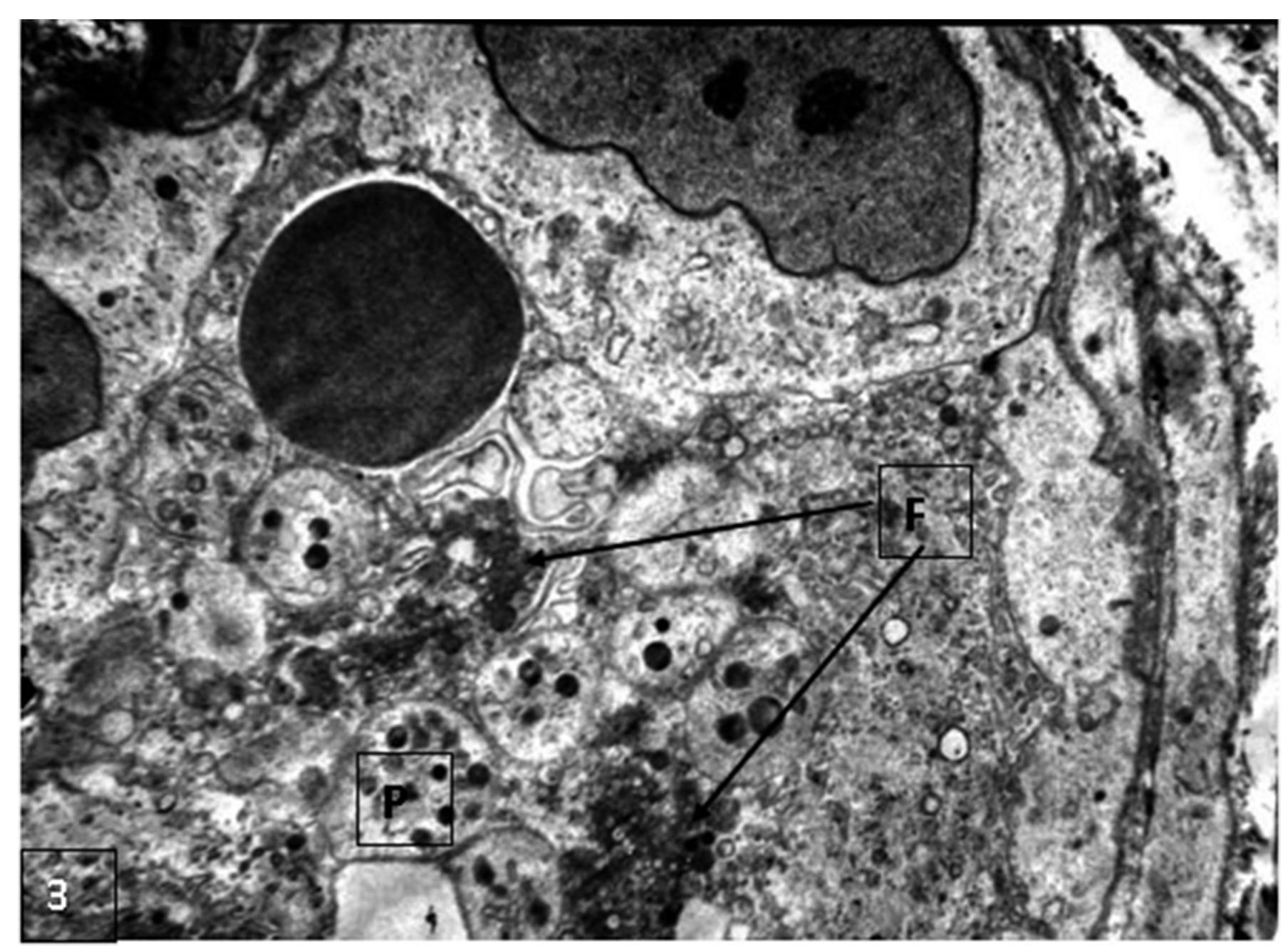 Ultrastructure of a vessel of connective tissue, the lumen