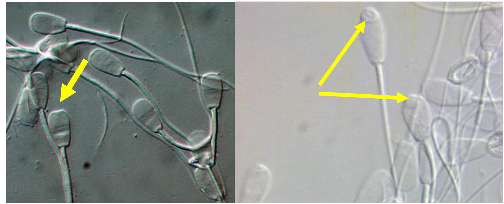 Left. knobbed acrosome, notched form (most common)