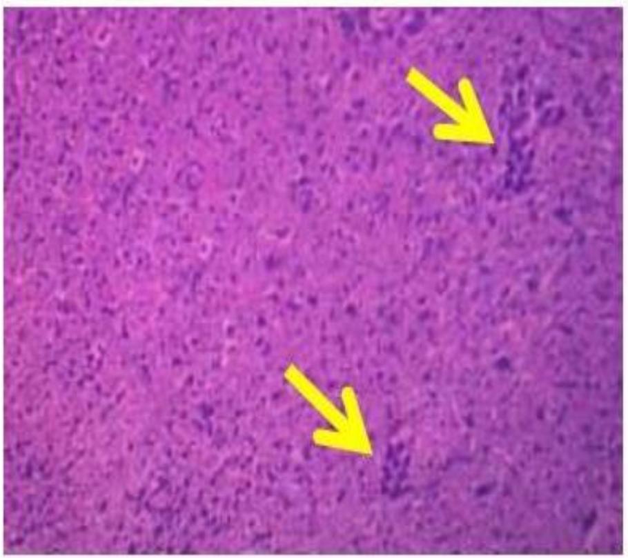 A. ts of cerebral cortex showing cellular condensation and