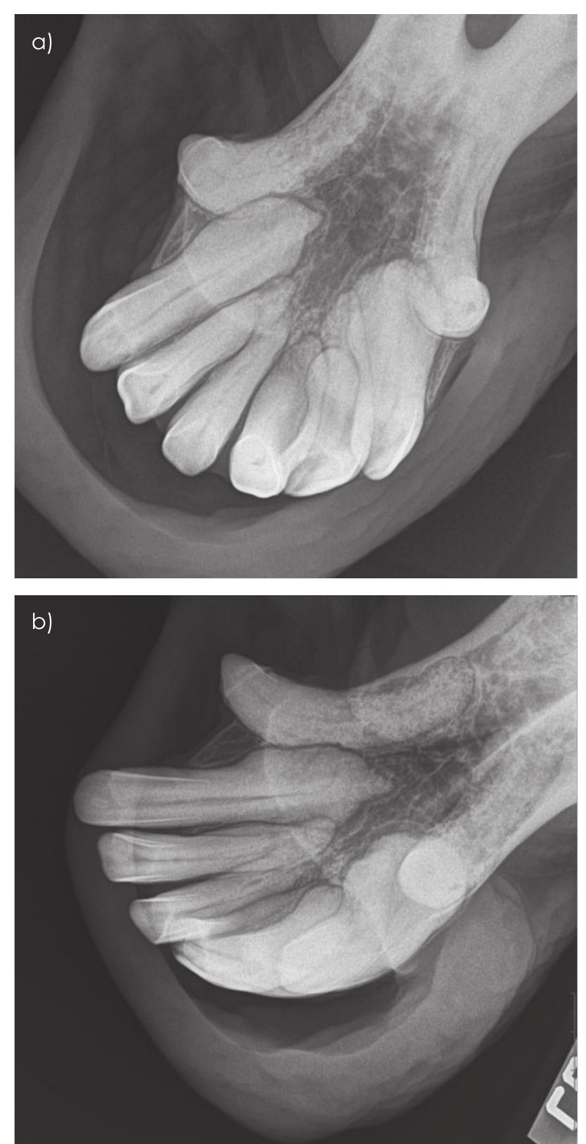 Mandibular incisor and canine intraoral ventrodorsal (a) and