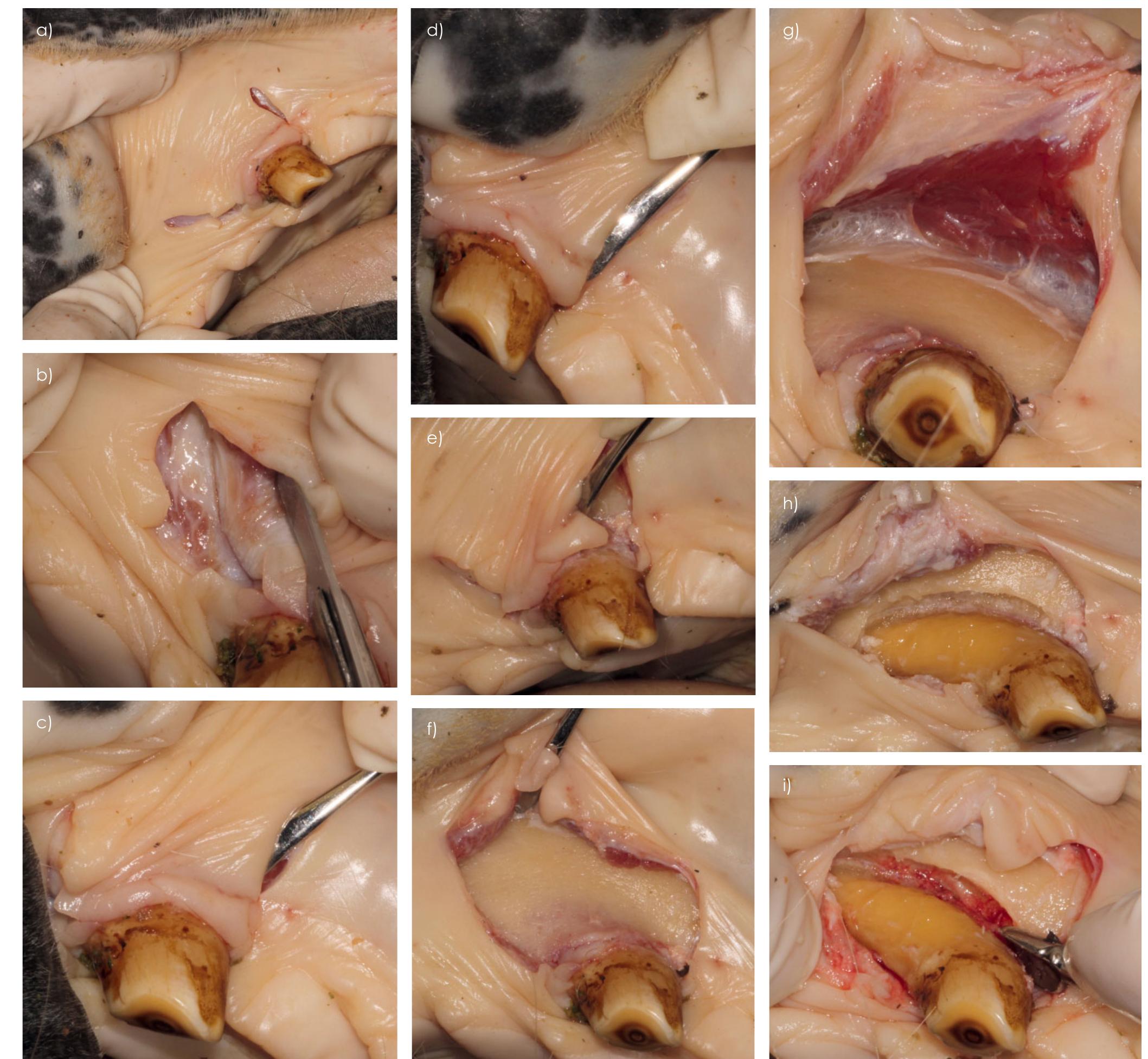 Steps to extraction of the maxillary canine tooth in a