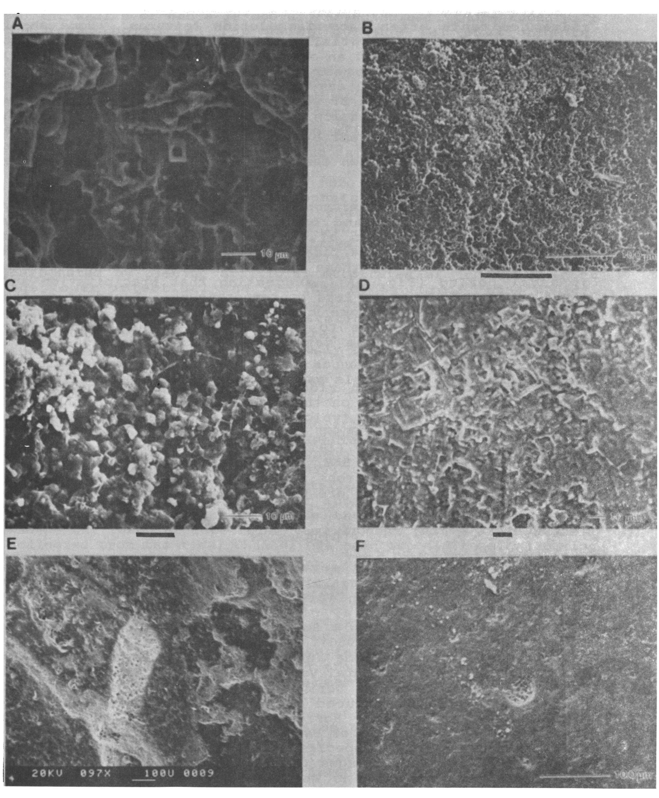 Figure 2 - Surface Textures of Shells as Taphonomic