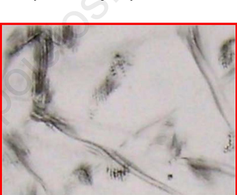 Figure 21 - New image processing of the Turin Shroud scourge