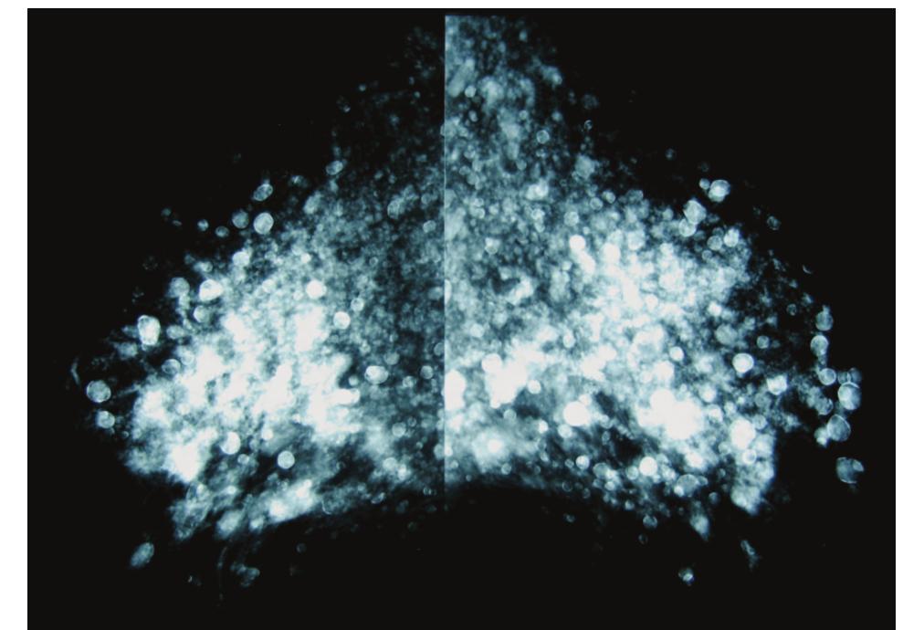 Figure 13 - from Brain Plasticity after Unilateral