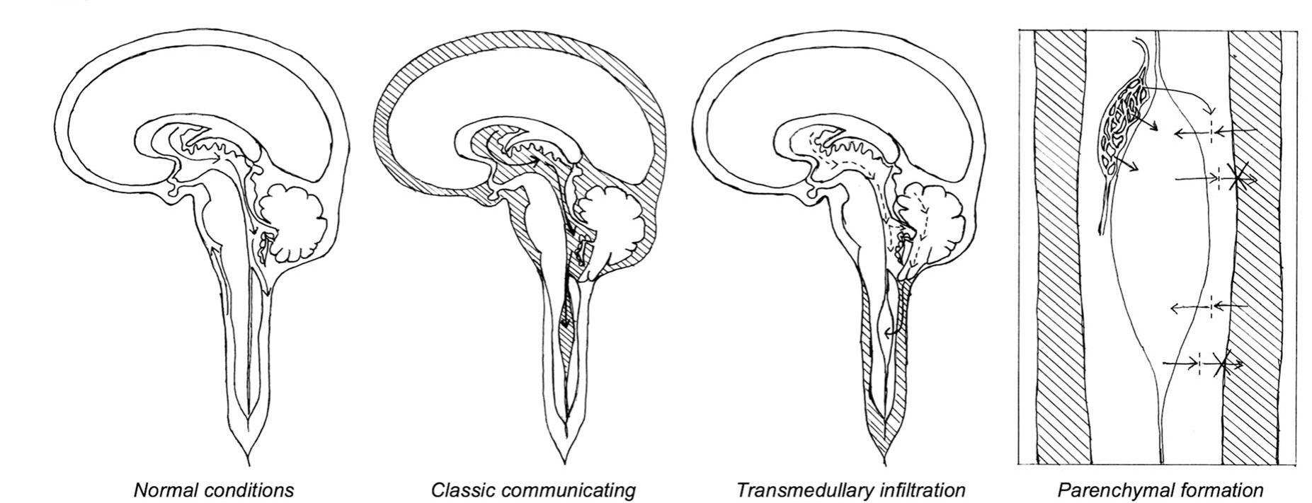 Illustration of the believed methods of spinal cord fluid