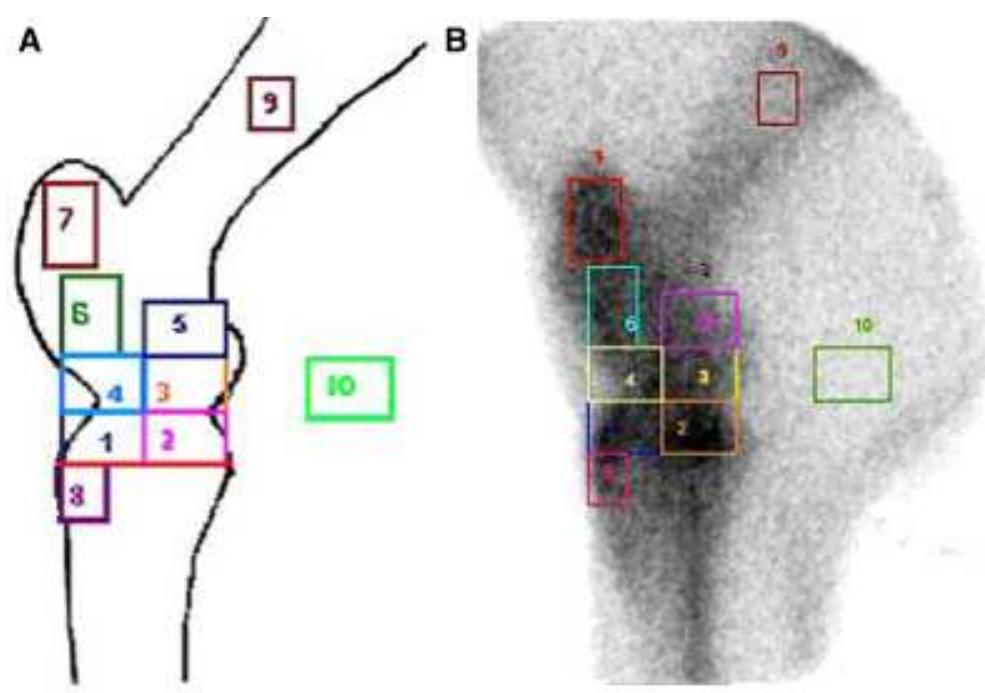 Fic. 1. diagram of region of interest (roi) location (a) and