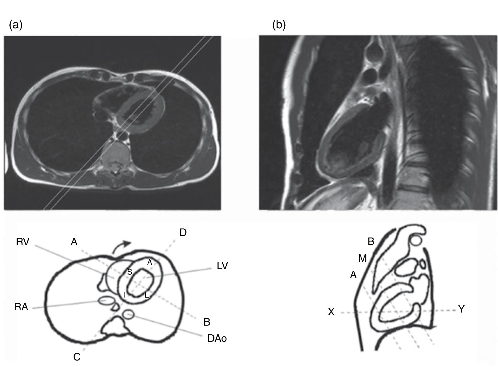 10 cmr imaging. (a) thoracic horizontal axial plane at the
