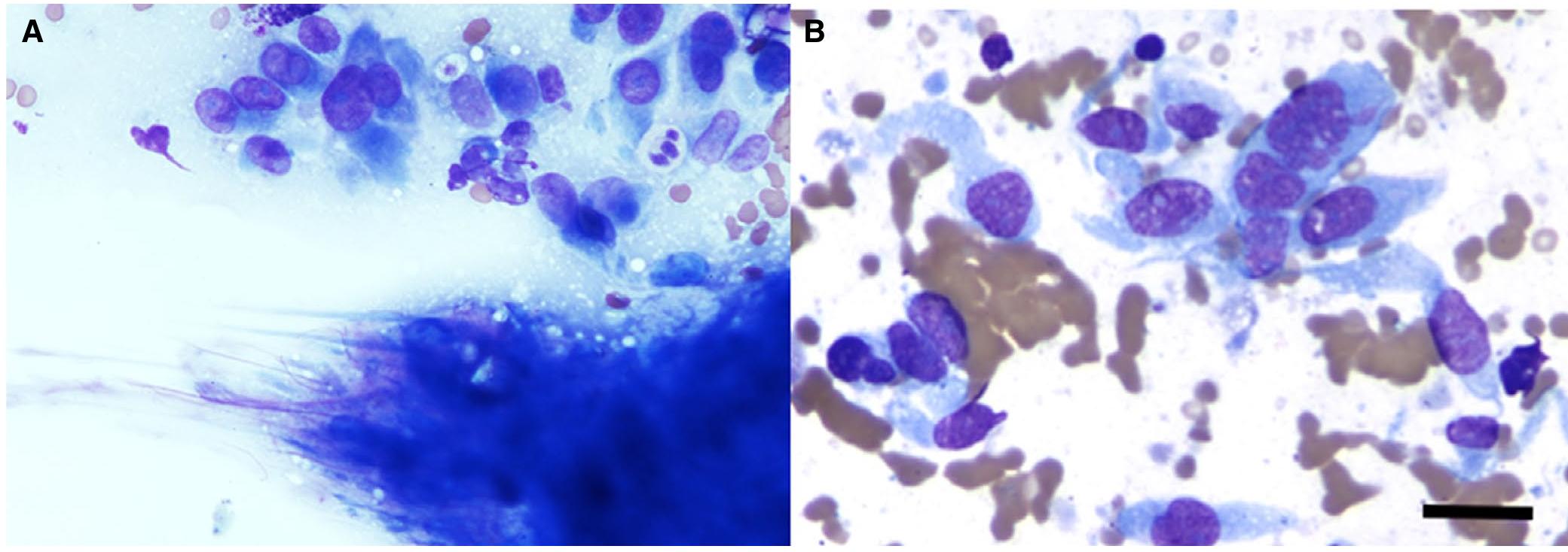 Photomicrographs of a direct smear from the fluid present