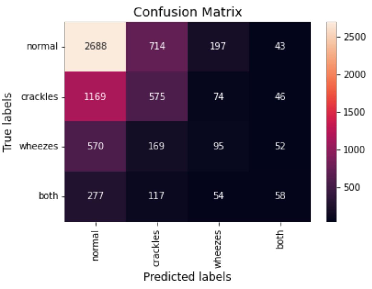 The overall confusion matrix for the cnn-lstm model with fl.