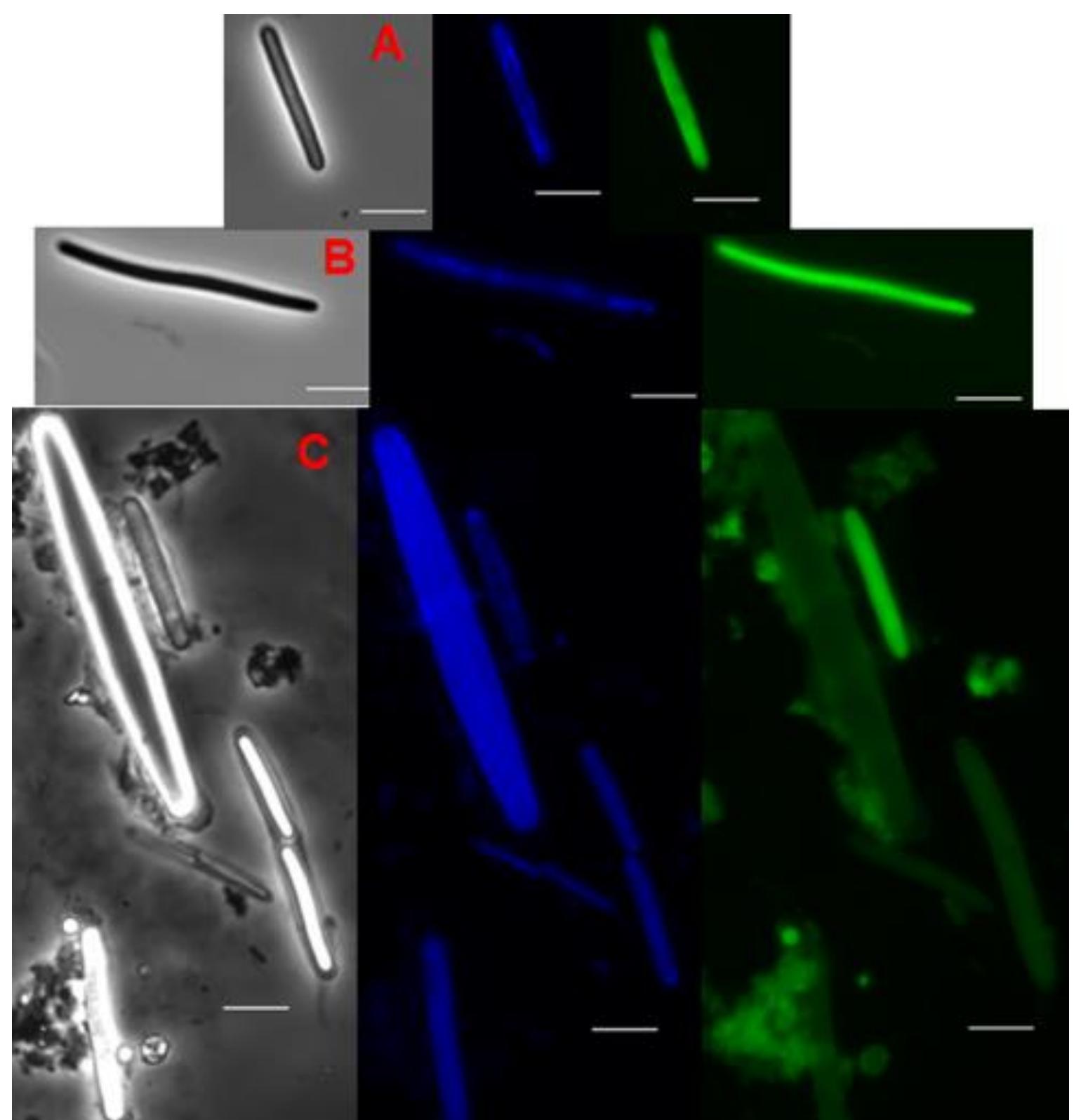 Igure 12 dapi and fish staining of epulos in the a.