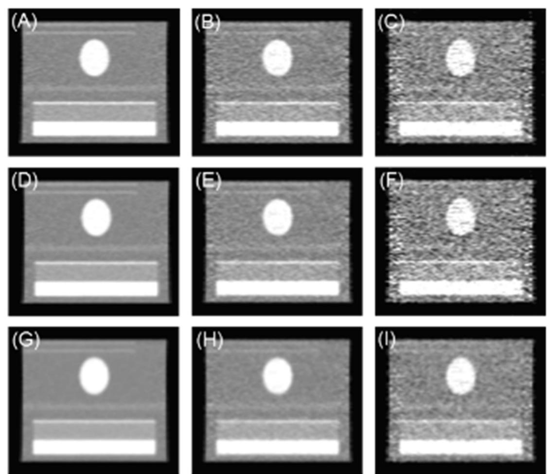 10: sagittal slice reconstruction of the reduced-size thorax