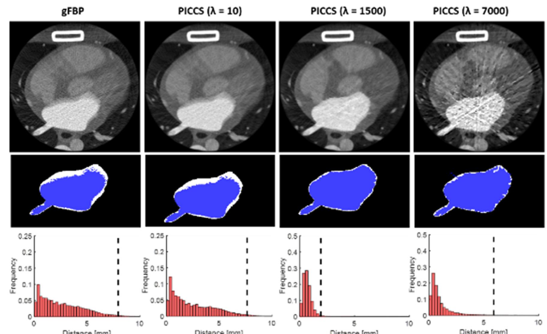 17: example reconstructions from projection data gated at