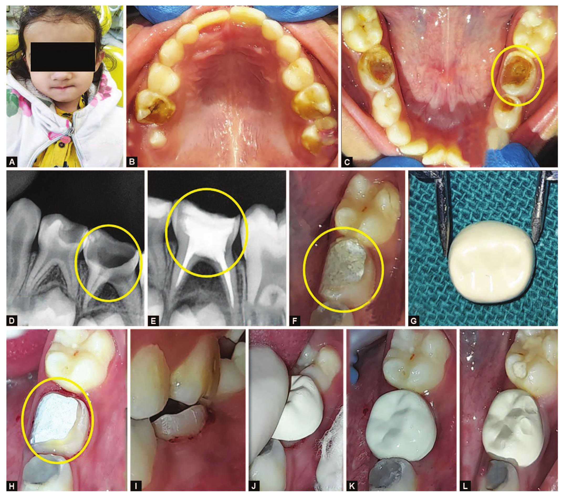 Figure 1 - from Esthetics in Pediatric Dentistry—BioFlx