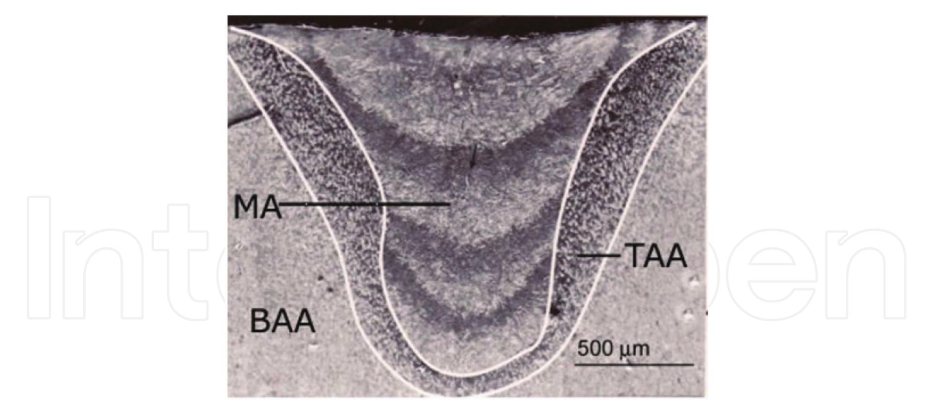 Sem observation of the ta6v4 cord sample after a single