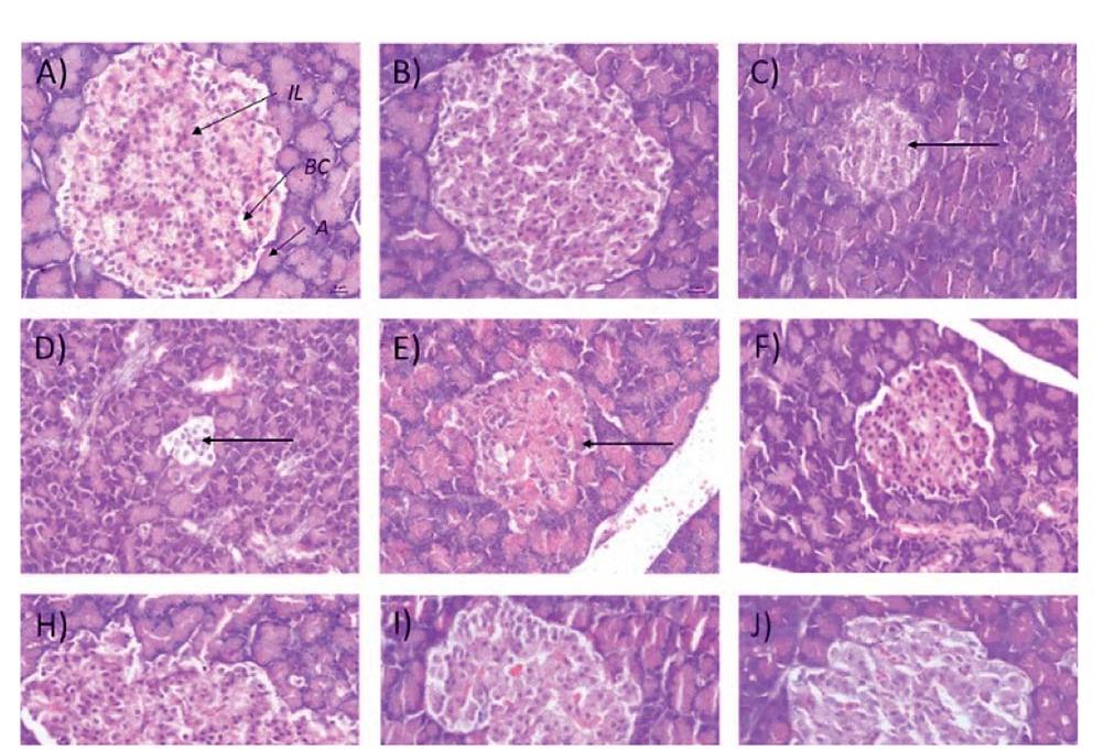 Histological structures of pancreas samples after 28 days of