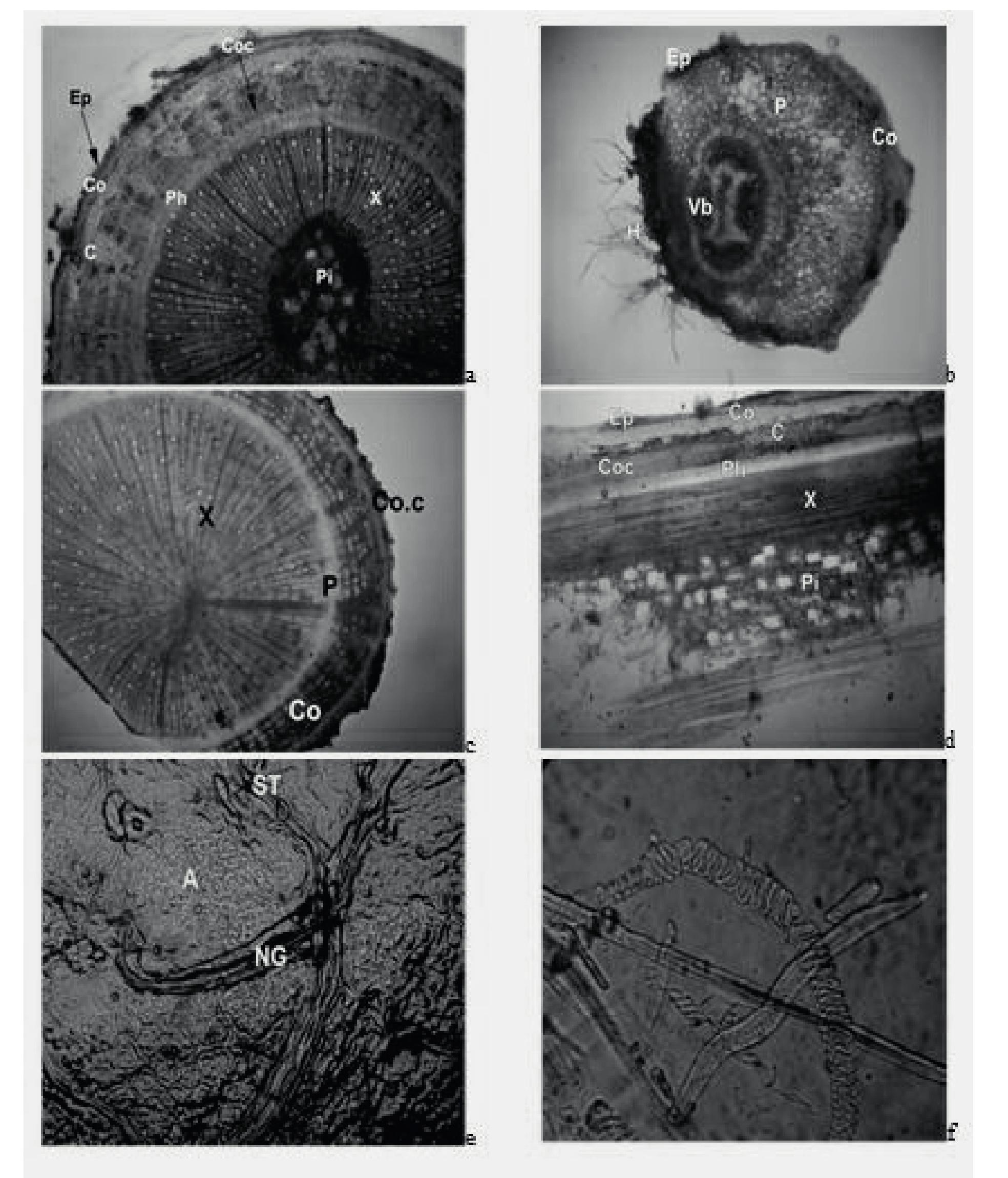 A micrograph showing the transverse section of sida acuta