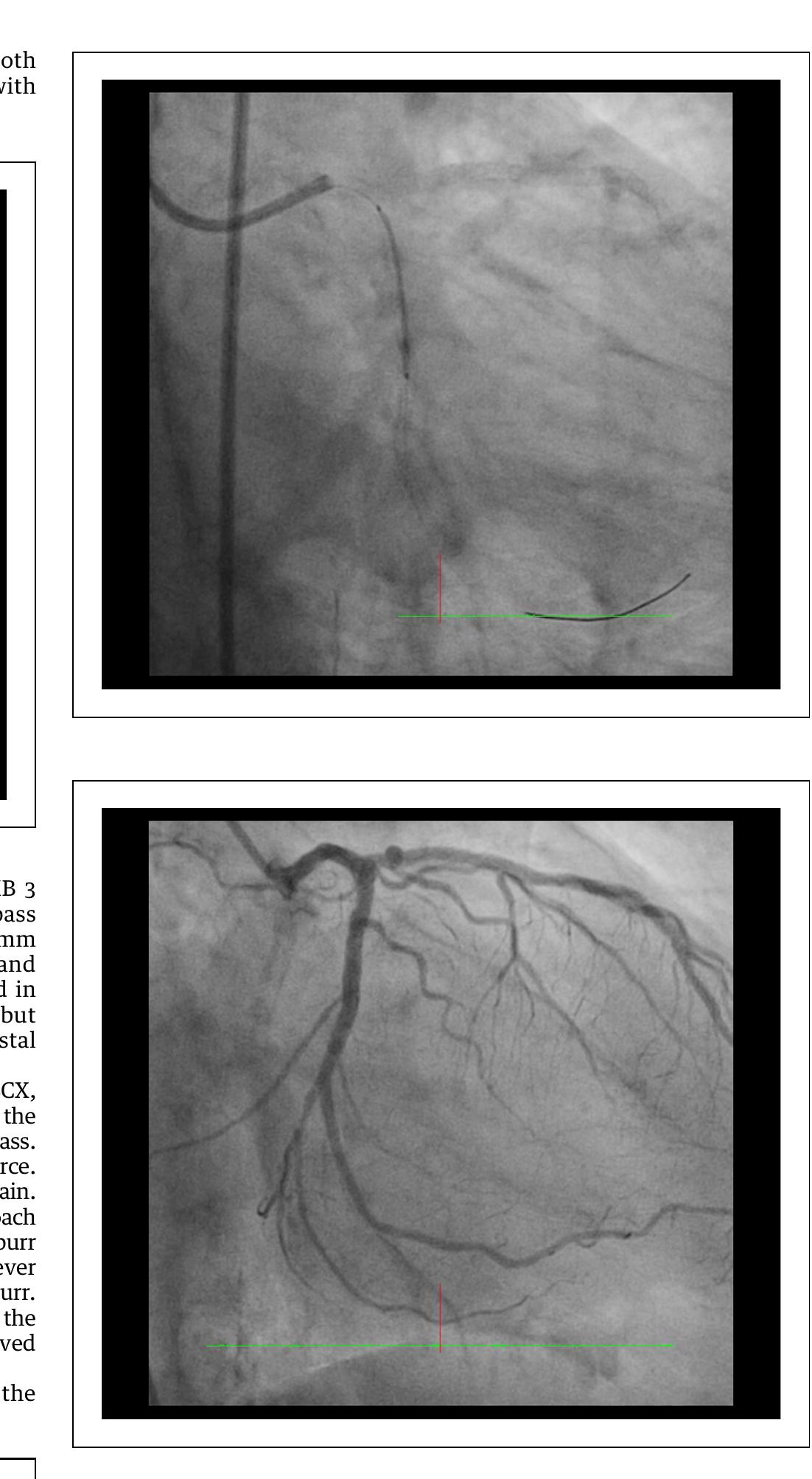 Figure 5 - from Transitioning Emergency Atrial Fibrillation
