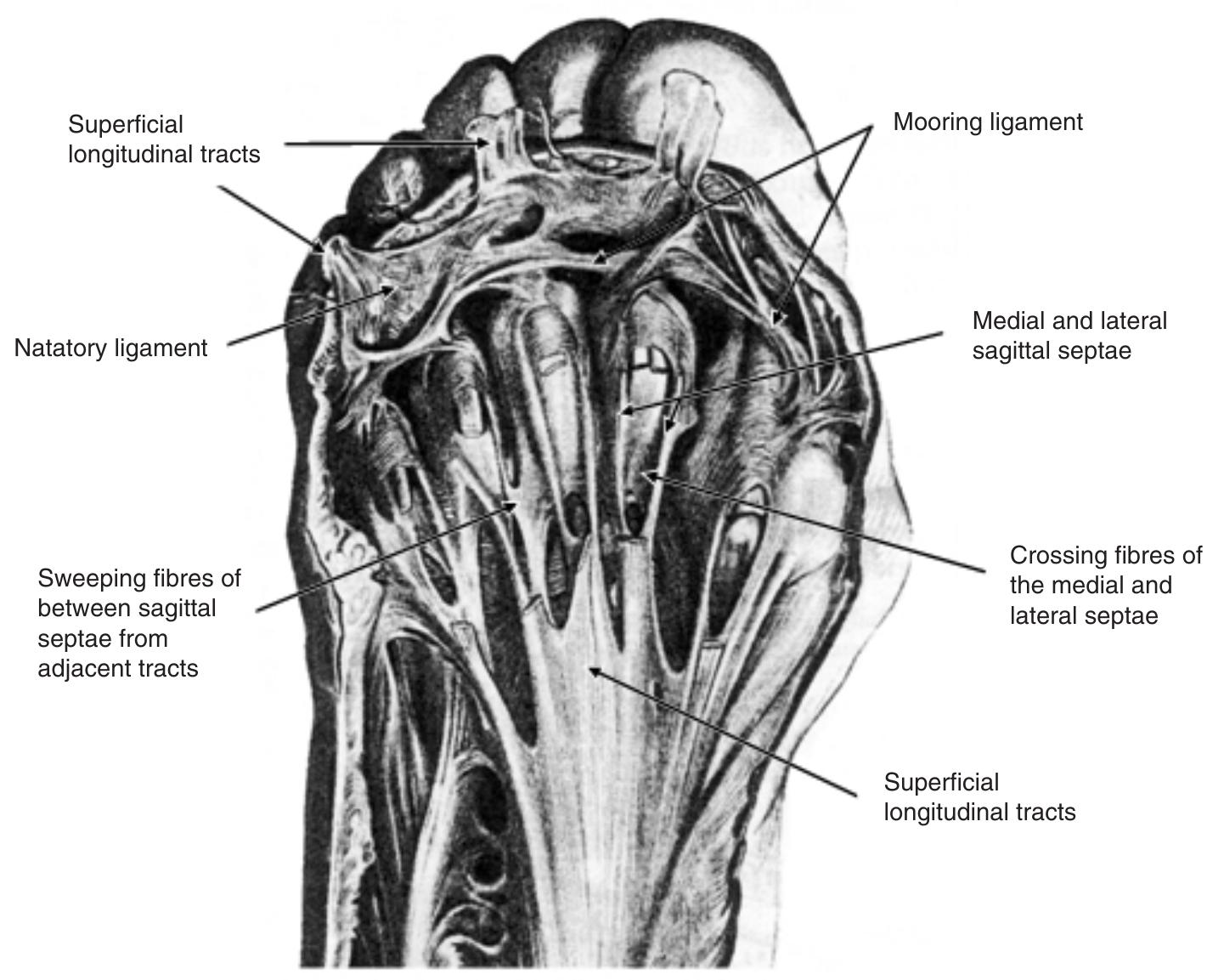 The distal insertion of the plantar fascia. note, for