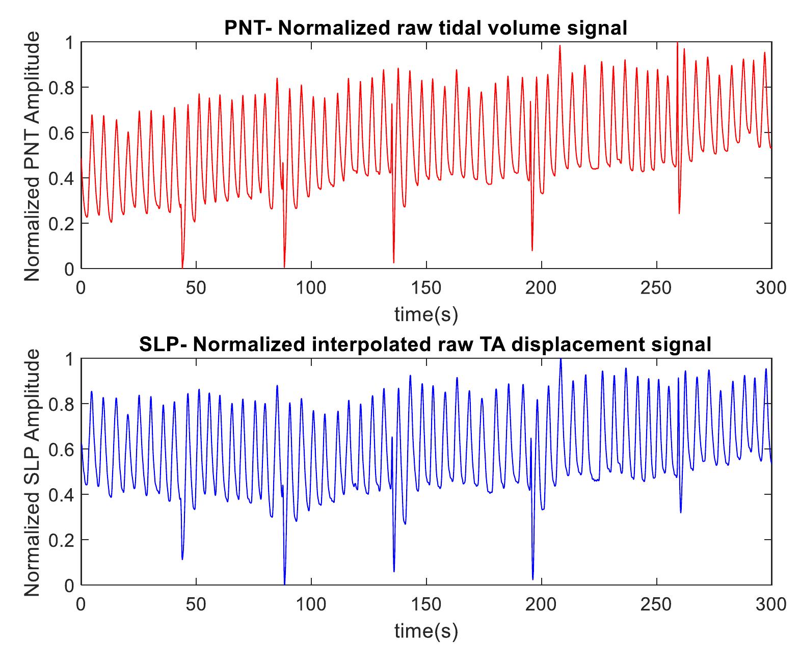 Figure 58 - Evaluation of Structured Light Plethysmography